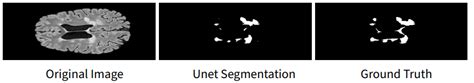 Github Mullefar1unet For Multiple Sclerosis Lesion Segmentation