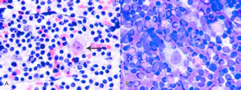 Photomicrography Cytologic Examination Of The Intraparotid Lymph Download Scientific Diagram