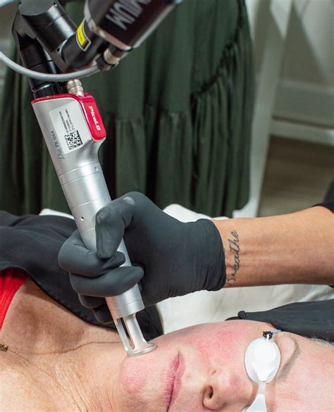 Helios 785 Pico — Laseroptek