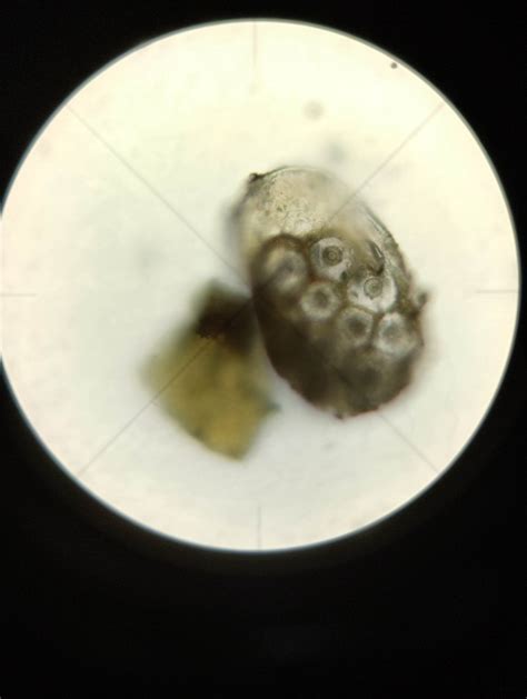 Microfossil Identification Fossil Id The Fossil Forum