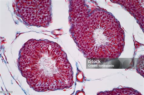 빛 현미경 보기의 밑에 인간 고환 정자 메이오증의 정자 세포 정자 정자를 보여줍니다 슬라이스에 대한 스톡 사진 및 기타 이미지 Istock