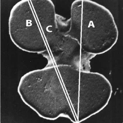 Illustration Of Three Ways Length Is Measured Line A Distance From