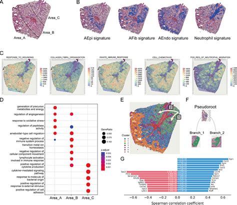 【文献解读】时空转录组学揭示小鼠弥漫性肺泡损伤模型中细胞的炎性状态 知乎