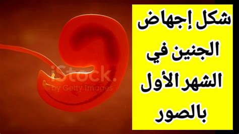 شكل إجهاض الجنين في الشهر الأولشكل الجنين إذا سقط في الشهر الأول