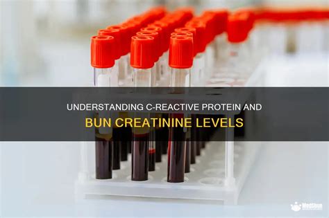 Understanding C Reactive Protein And Bun Creatinine Levels Medshun