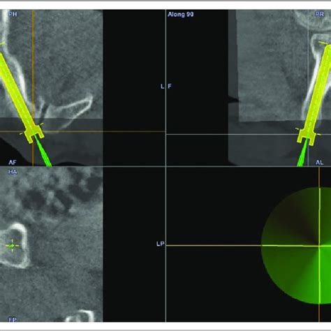 real time navigation being carried out download scientific diagram