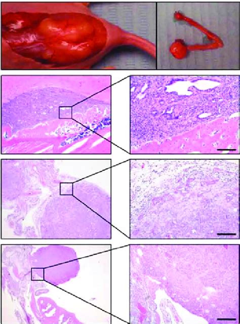 Cell Lines Derived From Spontaneous Metastasis Display Wide Download Scientific Diagram
