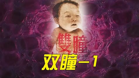 破腹产女婴双胞胎，一个死婴一个双瞳孔，可解释为胎中升仙高清1080p在线观看平台腾讯视频