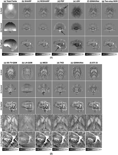 Total Fields And Qsm Background Removal Results 1 Susceptibility Download Scientific Diagram