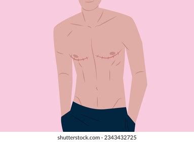Transgender Ftm