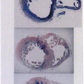 Technetium M Pyrophosphate Scintigrams Fromanterior A Leftanterior Download Scientific