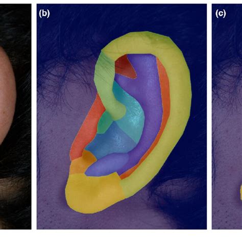 Ear Test Sample A With Experts Annotations B And Dlms Predictions Download Scientific