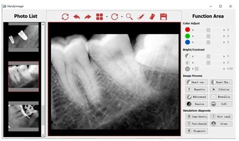 Handy Hdr 500 Hdr 600 Digital X Ray Cmos Sensor Al Mahdi Dental Supplies