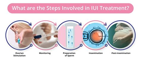 Iui Treatment Everything You Need To Know Birla Fertility And Ivf
