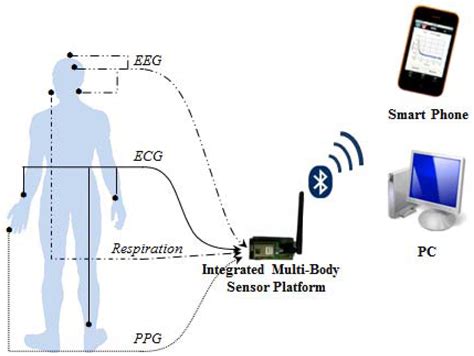 Sensors Free Full Text A Synchronous Multi Body Sensor Platform In A Wireless Body Sensor