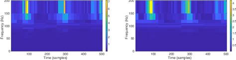 Figure 1 From Semg Feature Extraction Using Generalized Discrete Orthonormal Stockwell Transform