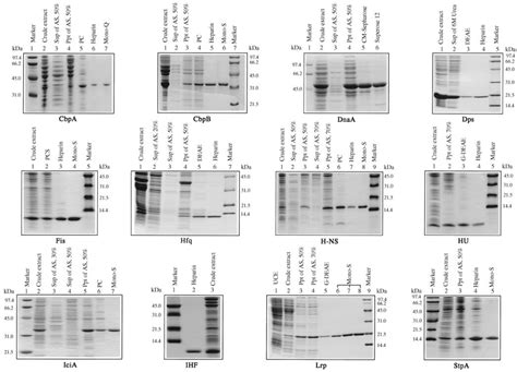 8 Polyacrylamide Gel Recipe Dna Bryont Blog