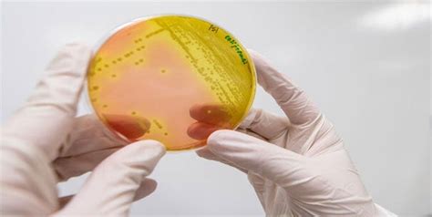 Patógenos Multirresistentes Que Son Prioritarios Para La Oms Ops Oms Organización