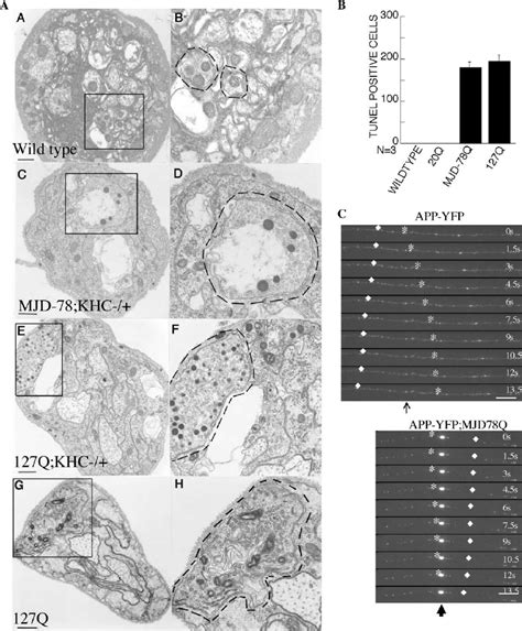 Expression Of Pathogenic Polyq Proteins Causes Organelle Accumulations