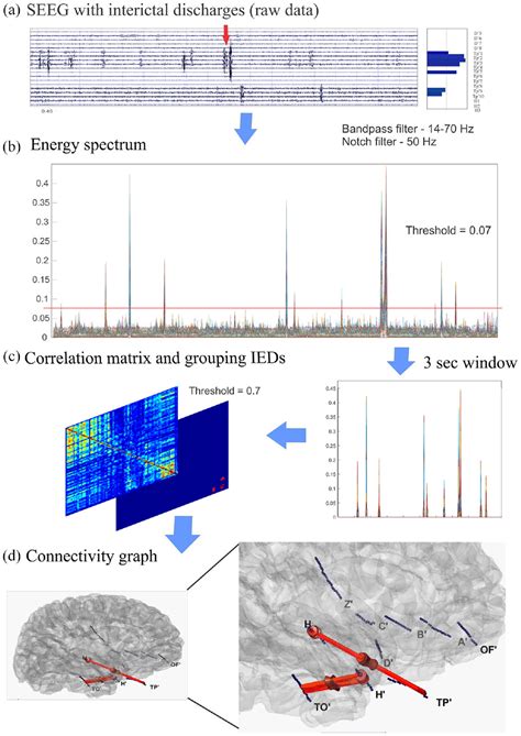 Localizing Epileptogenic Network From Seeg Using Non Linear Correlation Mutual Information And