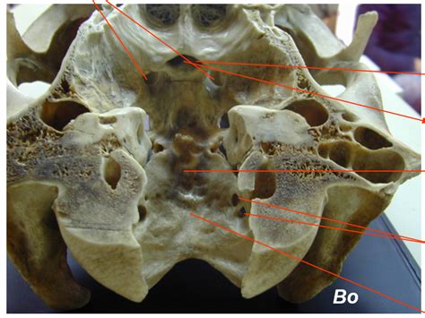 Bones Of The Cranium Presphenoid Bone And Basisphenoid Bone Diagram Quizlet