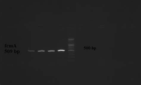 Gel Electrophoresis Of Amplified Fema Gene Of S Aureus Using Download Scientific Diagram