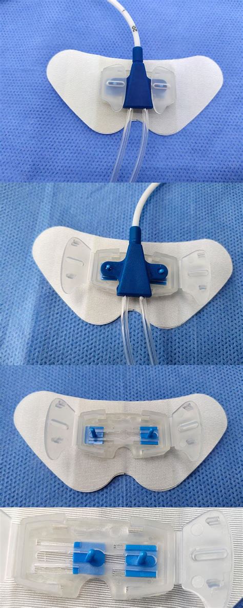 China Hot Sale PICC Line Securement Device Manufacturers Suppliers Factory Free Sample