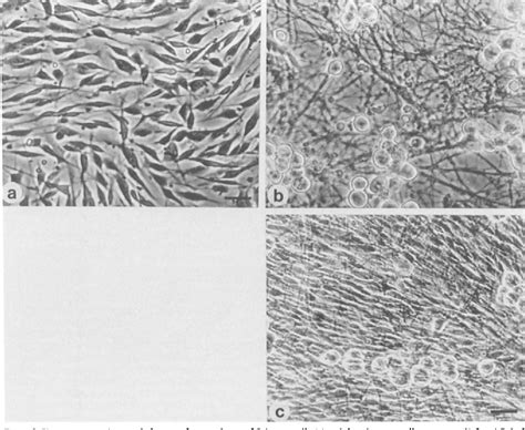 Figure 1 From Neural Cell Adhesion Molecule Expression Is Regulated By Schwann Cell Neuron