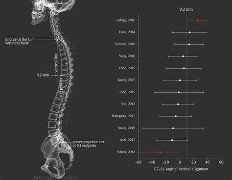 Pin On Sagittal Alignment Of The Spine🐀 Descubra A Emoção Do Jogo