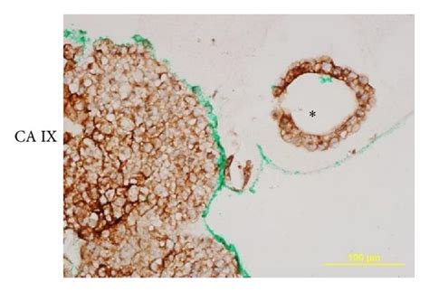 The Images Are Representative Of Immunohistochemistry Staining Of