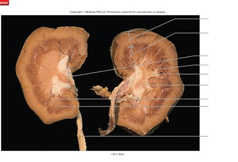 Renal Anatomy Cortex Medulla And Urinary Tract Structures Diagram