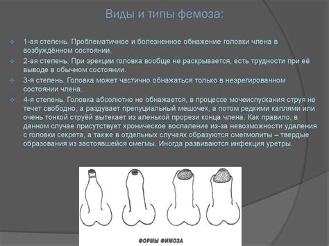 Фимоз Парафимоз Баланопостит презентация онлайн