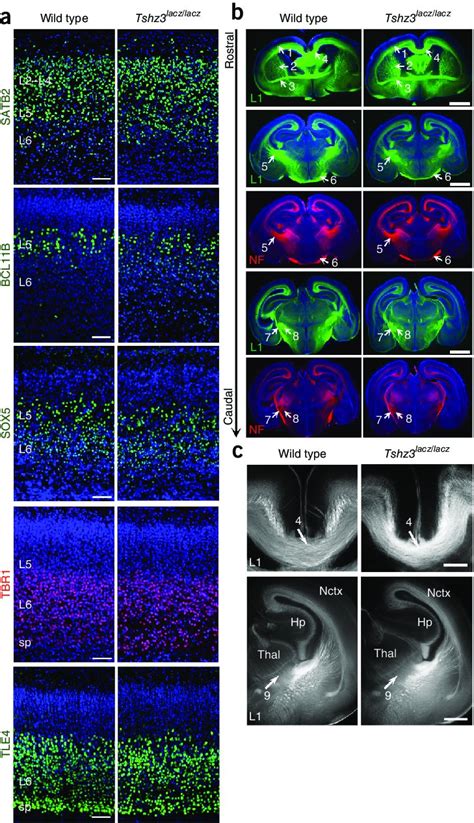 Cortical Layering And Major Axonal Tracts Are Preserved In Tshz3