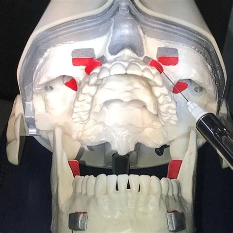 10 Sensor Oral Anesthesia Training Manikin
