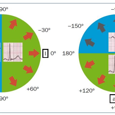 PDF Understanding The ECG Part QRS Axis