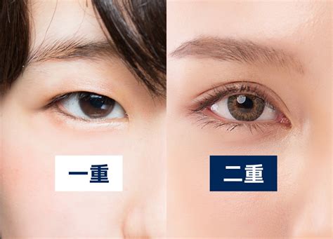 二重と一重の違いについて