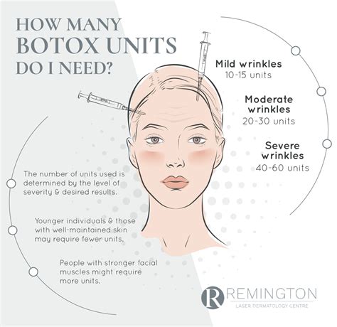 How Many Units Of Botox Are Needed For Forehead