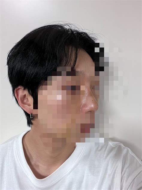 자유수다 강남 니트성형외과 강남언니 1등 성형수술and피부시술 정보앱