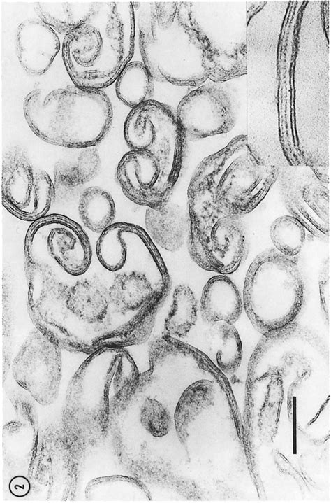 Electron Micrograph Thin Section Of Dna Envelope Complex Fragments