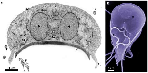 Ultrastructural Alterations Of The Human Pathogen Giardia Intestinalis