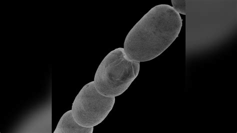 Worlds Largest Bacterium Discovered Is The Size Of A Human Eyelash Cnn