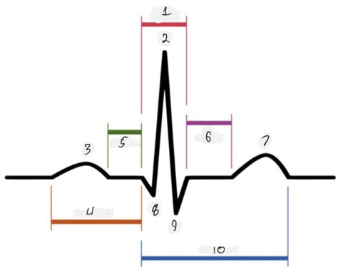 Ekg Identification Flashcards Quizlet