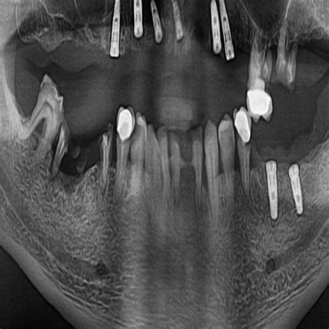 Graduation Project Object Detection Dataset By Ayshi
