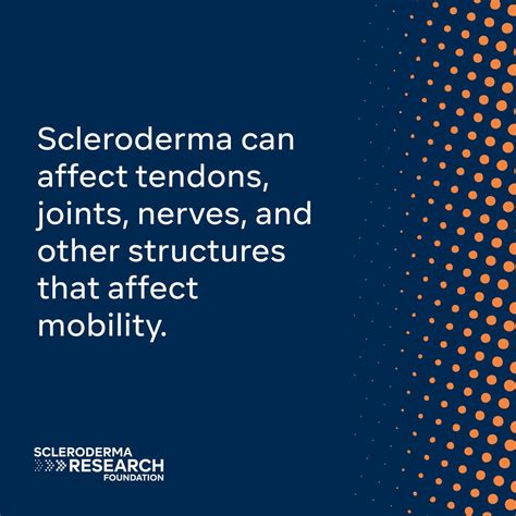 Dimitra Κ Bonia On Linkedin Scleroderma Or Systemic Sclerosis Is A