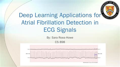 Deep Learning Applications For Atrial Fibrillation Detection In Ecg