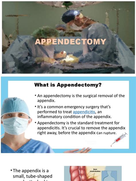 Appendectomy Pdf Ct Scan Medical Imaging