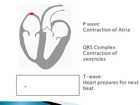 St Segment Analysis Stan For Intrapartum Electronic Fetal Monitoring Ppt