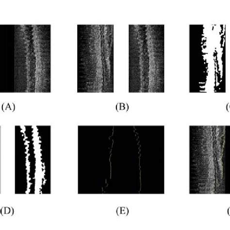 Example Of The Detection Luminal Contours On Longitudinal A Download Scientific Diagram