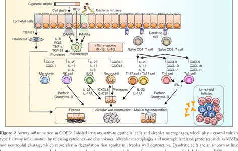 Smoking And Copd Pathophysiology At Eric Sain Blog