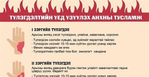 ГССҮТ Түлэгдэлтийн үед үзүүлэх анхны тусламж